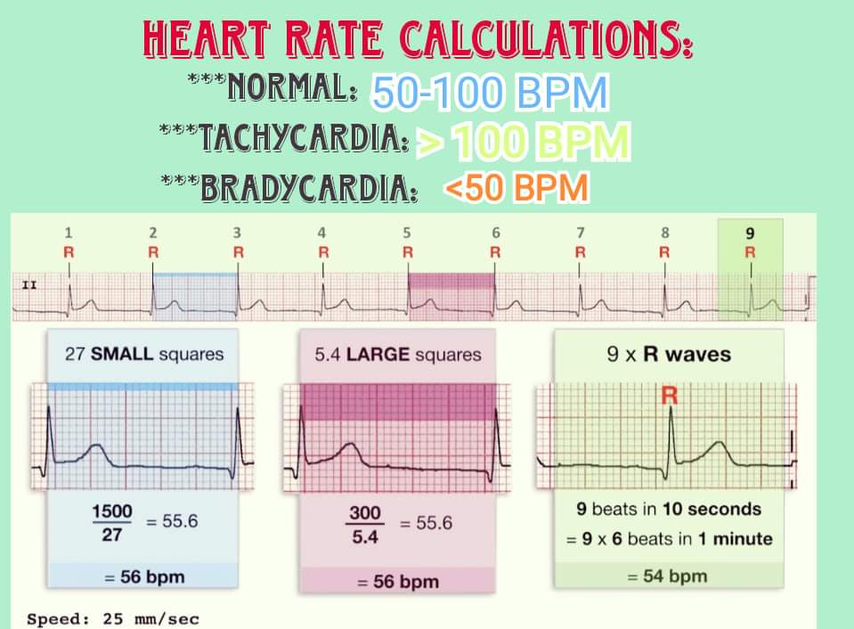 Steps To Interpret An Electrocardiogram For Healthcare Professionals Steps To Interpret An Electrocardiogram For Healthcare Professionals